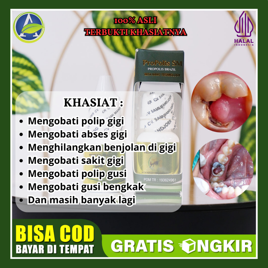 Jual Obat Polip Gigi Polip Pulpa Abses Gigi Benjolan Di Gigi Sakit Gusi ...