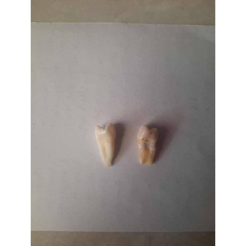 Jual 4 buah gigi determinasi premolar dan molar | Shopee Indonesia