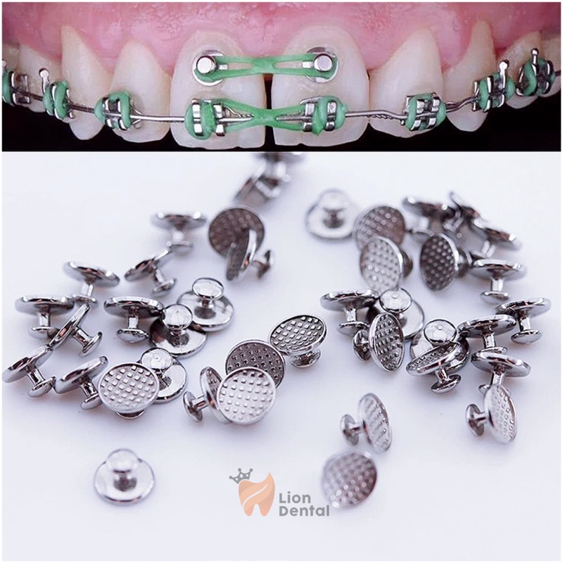Jual Lingual Button USA Isi 10 pcs Dental Ortho Lingual Buton ...