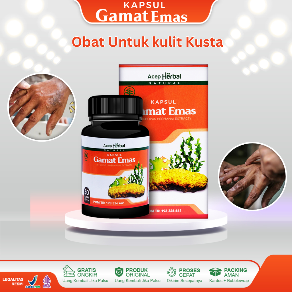 Jual Obat Kusta Lepra Kusta Kering Basah Gatal Kulit Pembasmi Bakteri ...