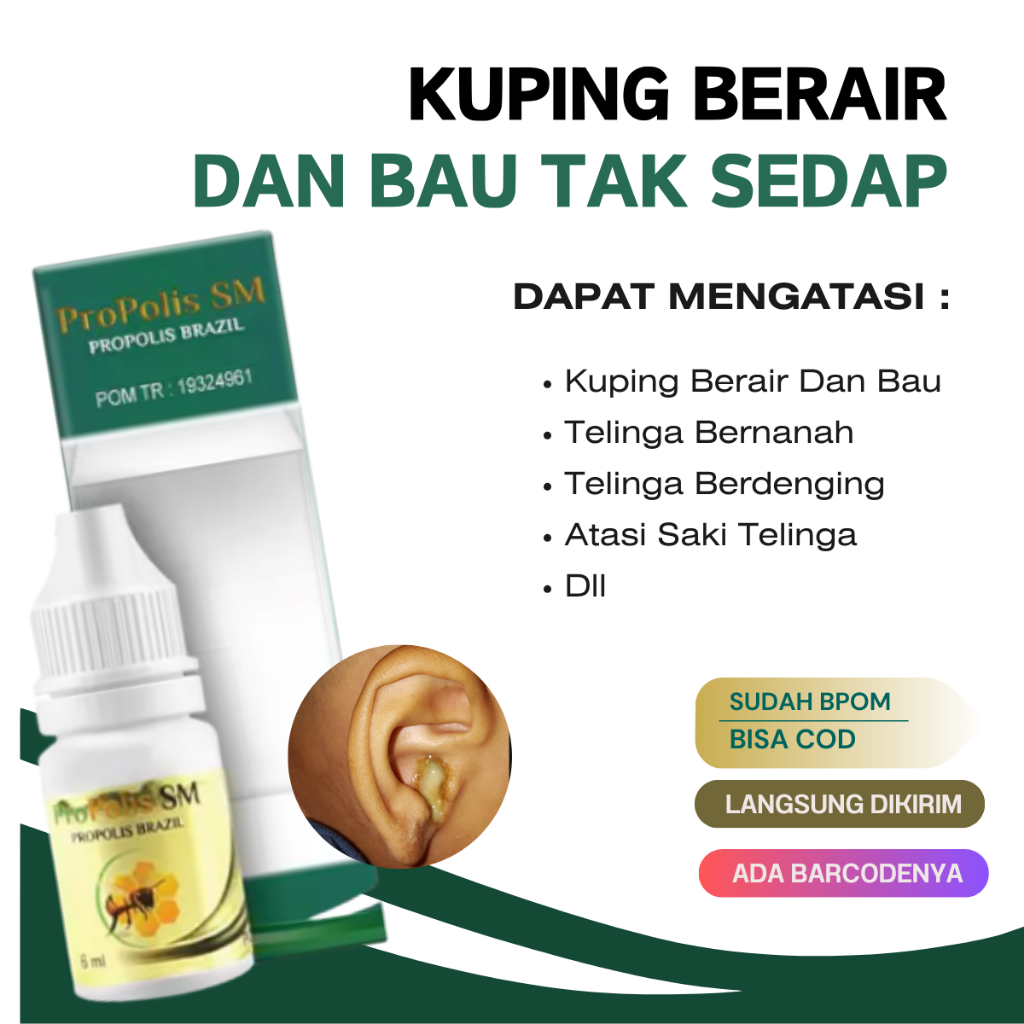 Jual Propolis SM Brazil Telinga - Obat Kuping Berair Dan Bau Tak Sedap ...