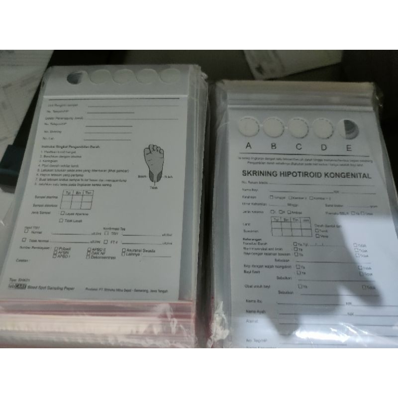Jual Kertas SHK / Hipotiroid kongenital isi 100 pcs | Shopee Indonesia