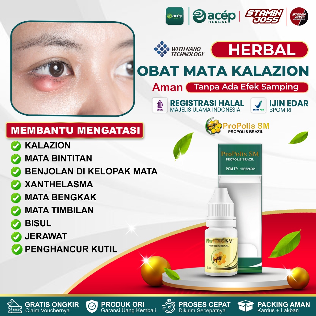 Jual Obat Mata Kalazion Original Oles Mata Bintitian Timbilan Mata ...