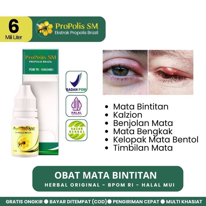 Jual Obat Timbilan Pengempis Bintitan Di Kelopak Mata Kalzaion Benjolan ...