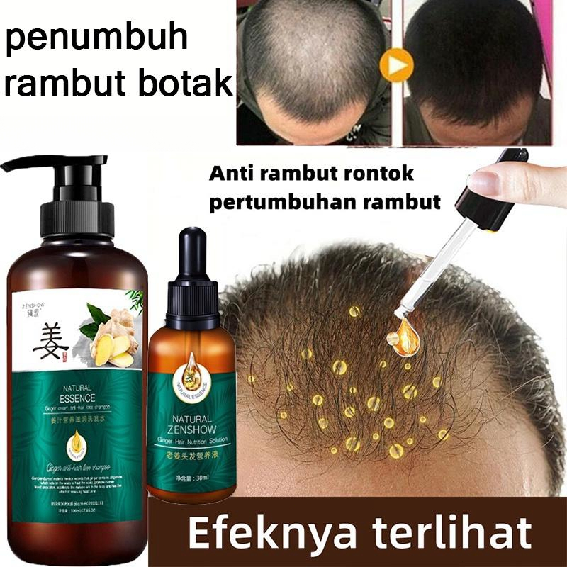 Jual Shampo Herbal Jahe/Sampo Penumbuh Rambut Cepat /Shampoo Anti ...