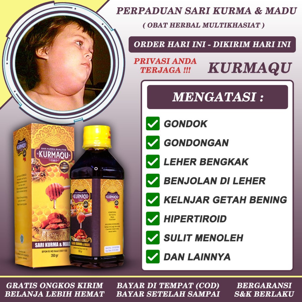 Jual Obat Gondok Gondongan Kelenjar Getah Bening Hipertiroid Benjolan ...