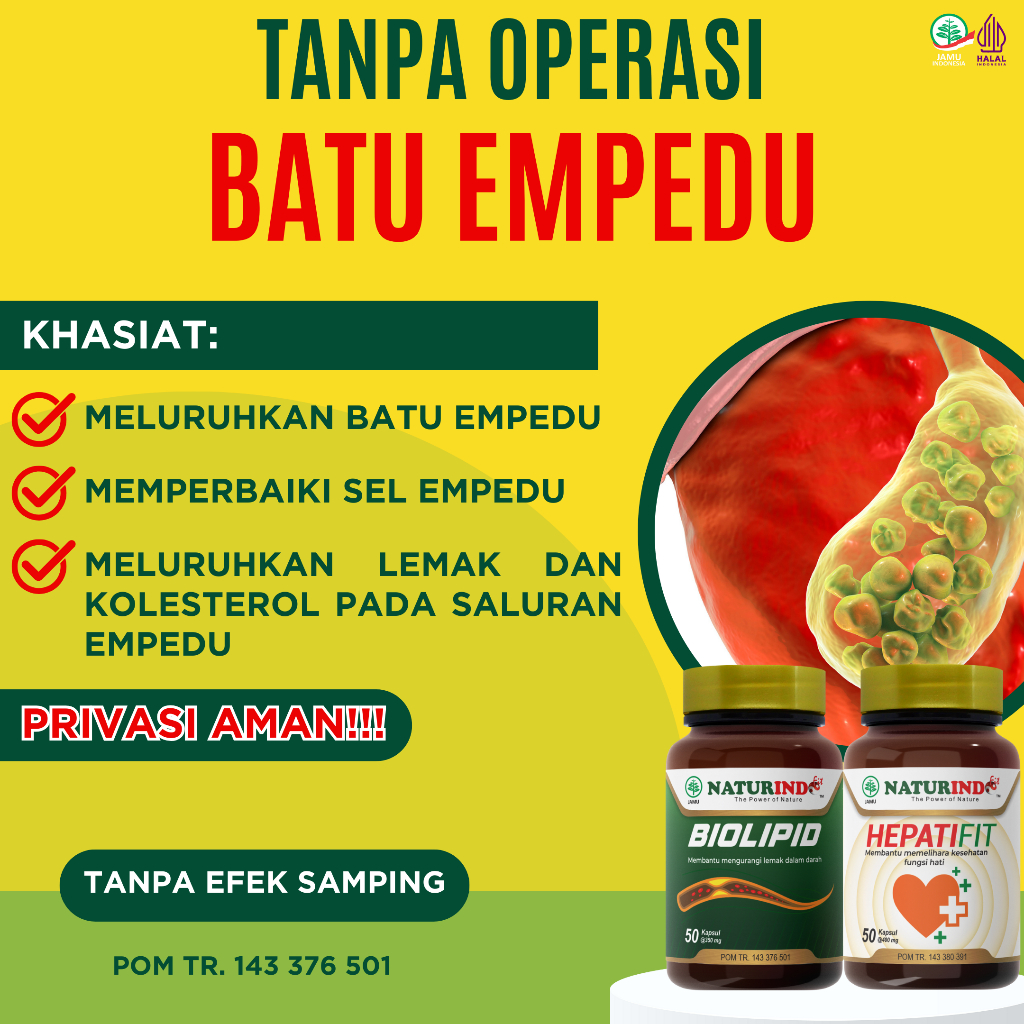 Jual Biolipid Naturindo Obat Batu Empedu Herbal Tanpa Operasi ...