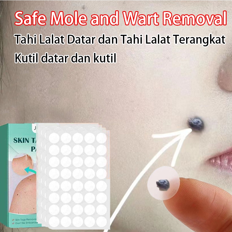 Jual penghilang tahi lalat stiker penghilang tahi lalat penghilang tahi ...