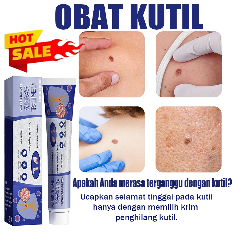 Jual Wart Removal cream, Obat Penghilang Kutil Tahi-Lalat Paling Ampuh ...