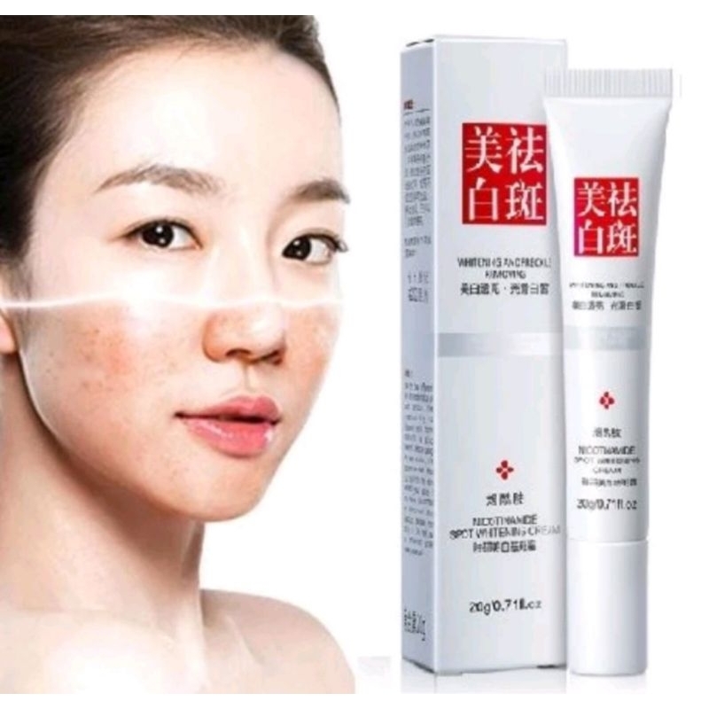Jual FUYAN WHITENUING FRECKLE CREAM REMOVE DARK SPOTS PENGHILANG BINTIK HITAM | Shopee Indonesia