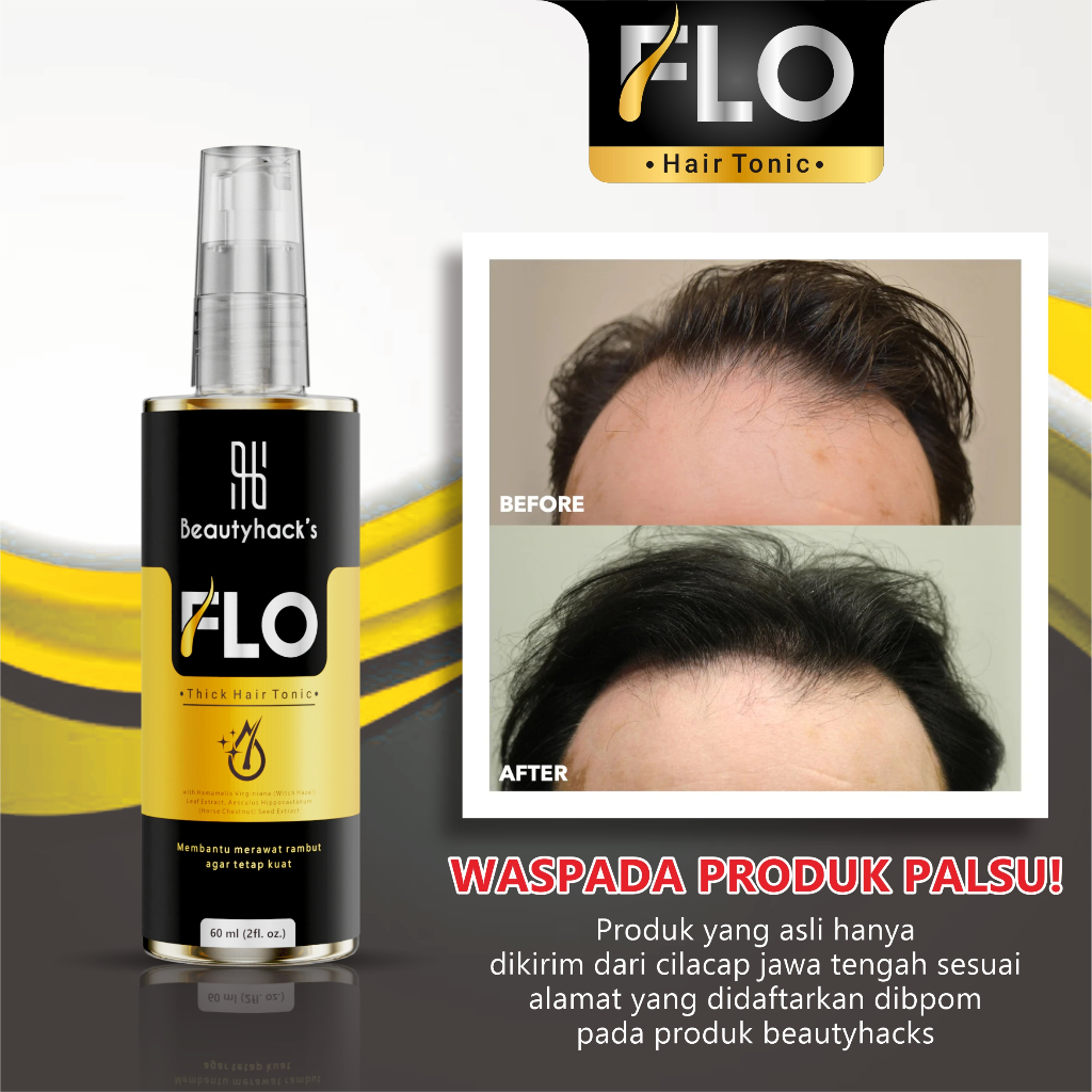 Jual FLO Hair Tonic Penumbuh Rambut Kebotakan Cepat dan Tebal Permanen ...