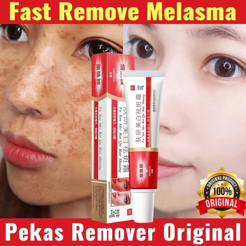Jual [ ORIGINAL 100% ] BEOTUA WHITENING FRECKLE CREAM Penghilang Flek Hitam Krim Salep Bekas ...