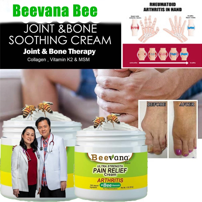 Jual Beevana Bee Venom Cream 30g/Krim Tulang dan Sendi Racun Lebah ...