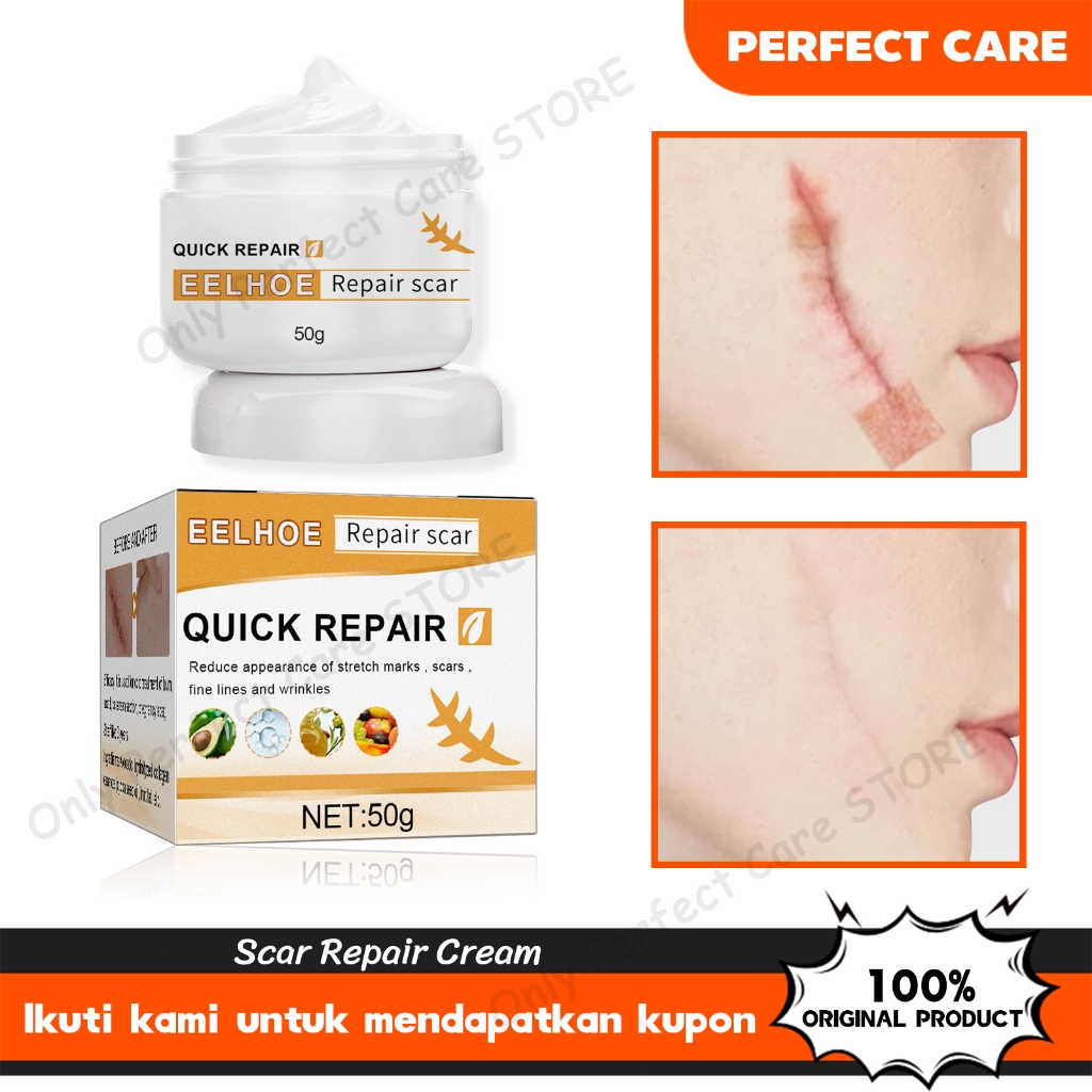 Jual EELHOE Surgical Scar Repair Cream Repair Scar Quick Repair