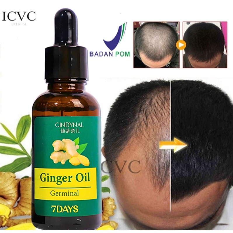 Jual [BPOM] CINDYNAL 7 Day Ginger Serum 7 Days Hair Tonic Ginseng ...