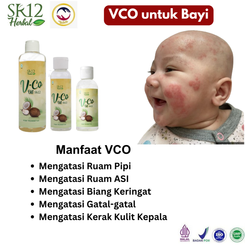 Jual Obat Ruam Pipi dan Ruam Popok pada Bayi dan Dewasa Virgin Coconut ...