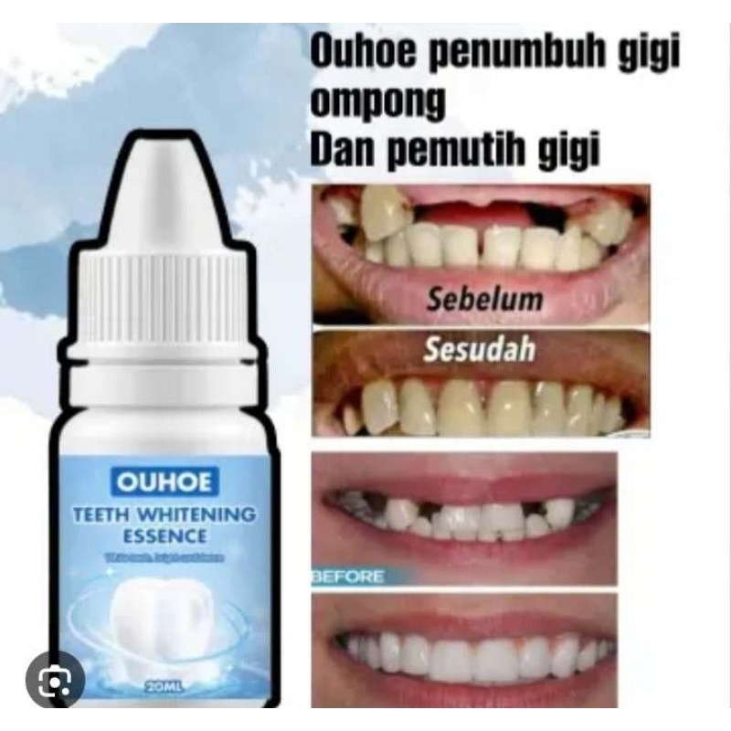 Jual [ COD ] TOOTH DECAY | GROSIR | OBAT TETES PENUMBUH GIGI BOLONG ...