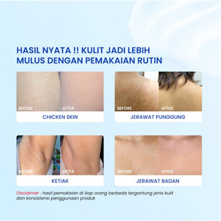 Jual Rintik Skincare - No Bump Lotion/Lotion Tubuh Kulit Bruntusan, Jerawat Punggung & Chicken ...