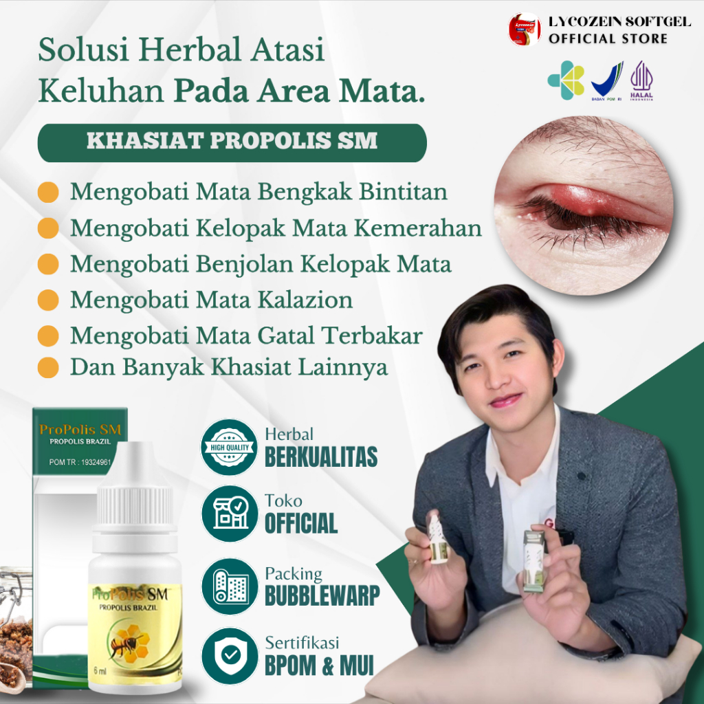Jual Obat Mata Bintitan Penghilang Benjolan Di Kelopak Mata Pada Anak ...