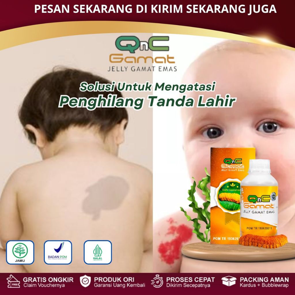 Jual Obat Penghilang Tanda Lahir Hemangioma, Tanda Lahir Merah Menonjol ...