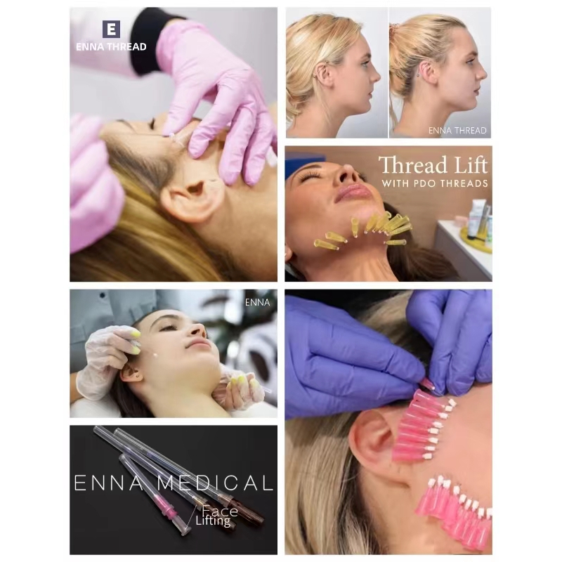 Jual Minerva TANAM BENANG THREAD LIFT super VLift tanam benang korea ...