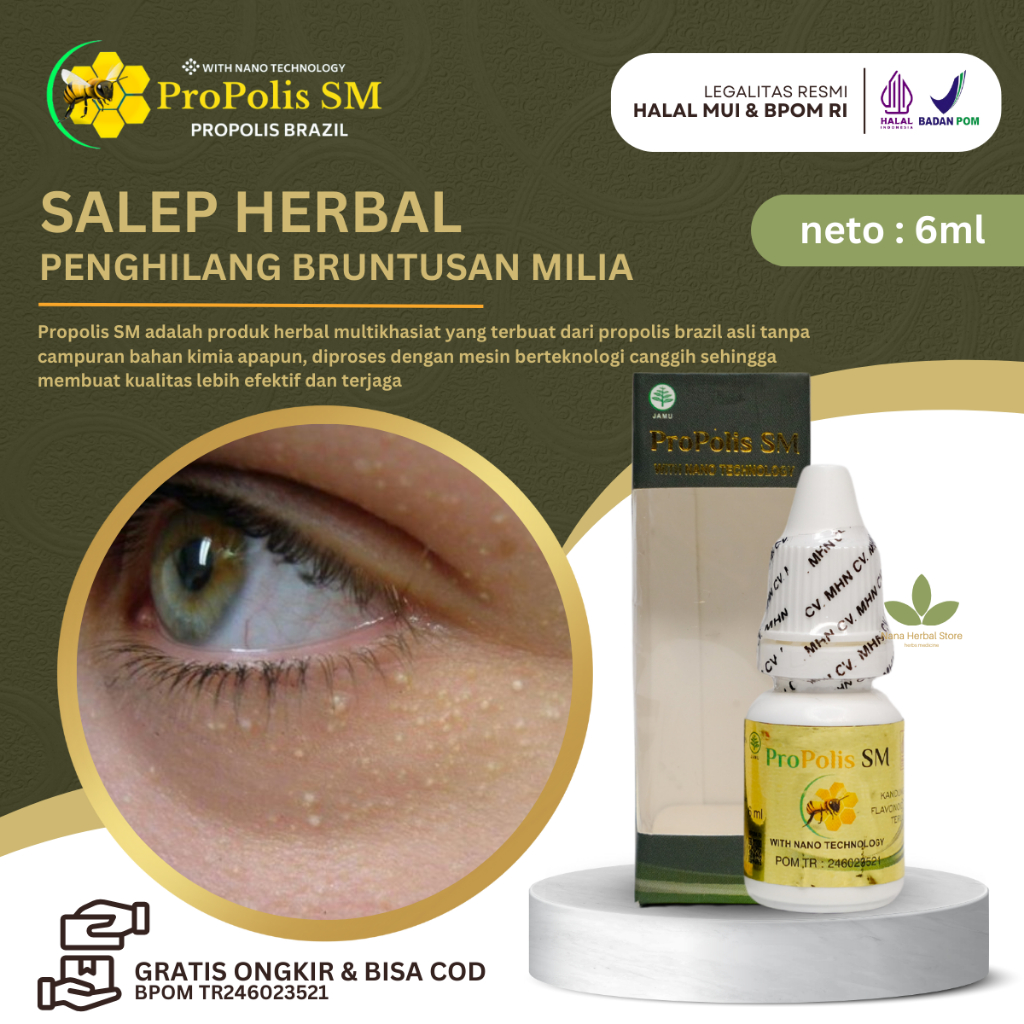 Jual Propolis SM Brazil 6ml Obat Oles Penghilang Milia Bintik Putih di ...