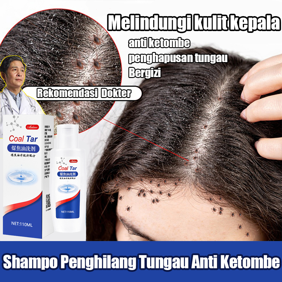 Jual Shampoo Kutu Rambut Sampo Ketombe Shampo Kutu Rambut Anak Telur Kutu Rambut Shampo Anti ...