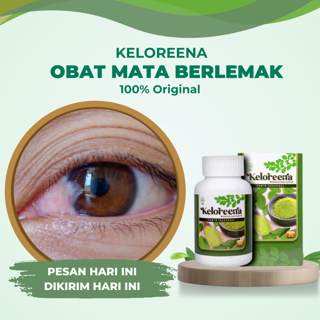 Jual Obat Mata Berlemak, Pterygium, Penghilang Lemak Di Mata, Gangguan Selaput Mata Buram, Mata ...
