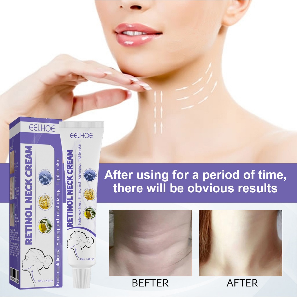 Jual EELHOE Retinol Neck Cream Firming Neck Menghilangkan Kerutan Leher ...
