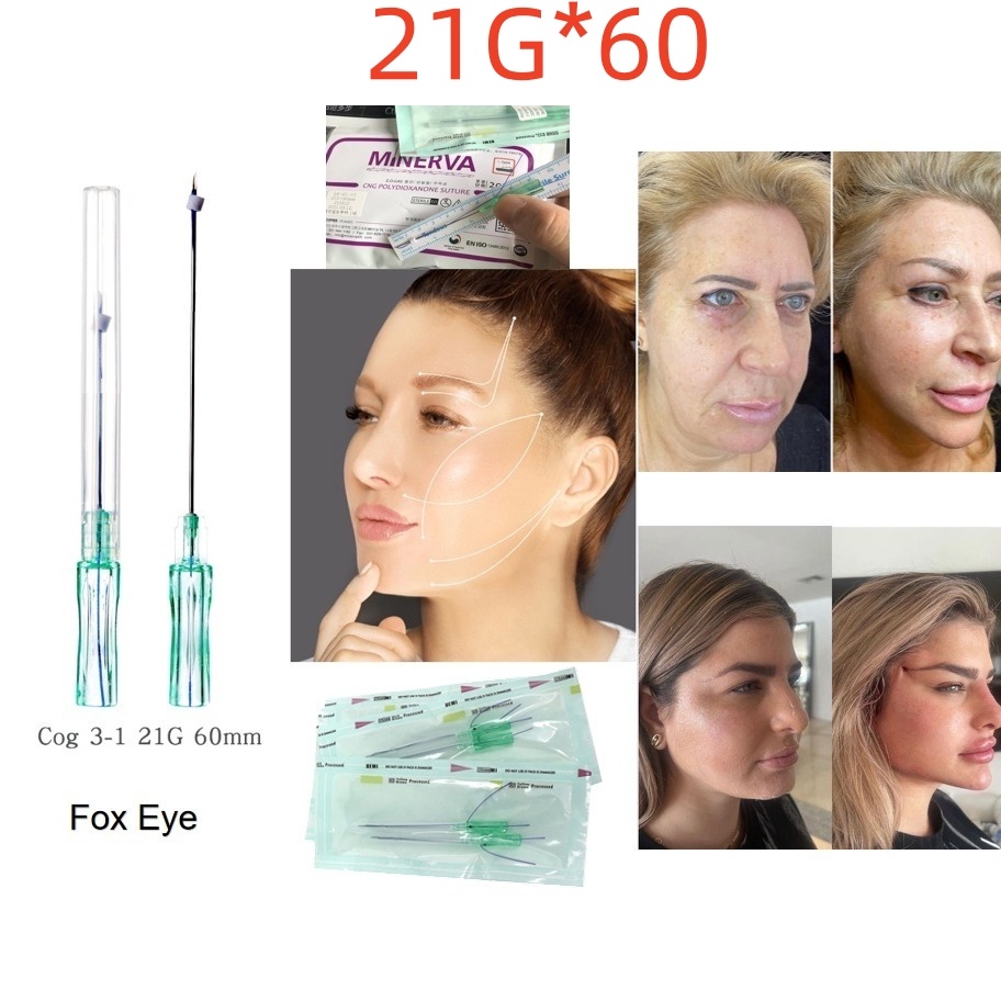 Jual KODE A69O Minerva FOX EYE THREAD PDO 21G x 6mm Benang Foxy Eyes Retail price for 1 pack of ...