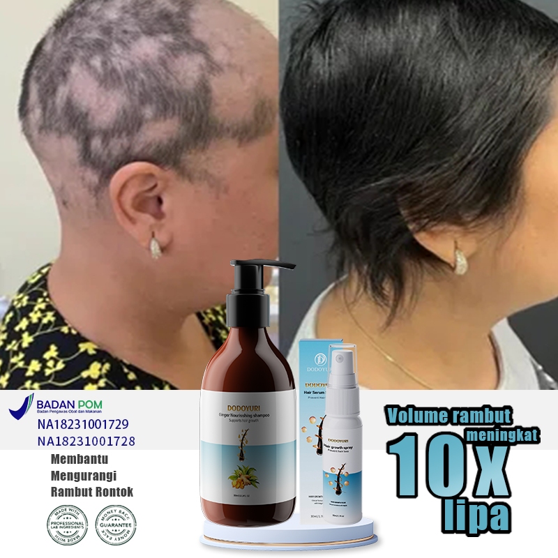 Jual [BPOM] DODOYURI Hair tonic rambut rontok Serum penumbuh rambut ...