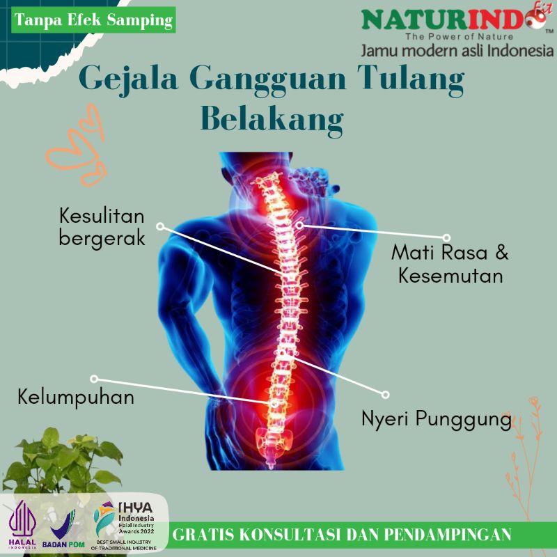 Jual Obat Sakit Pinggang Sampai Kaki Sakit Bokong Saraf Kejepit ...