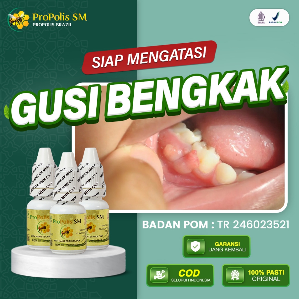 Jual Obat Gusi Bengkak Sakit Gigi Berlubang Radang Gusi Periodontitis ...