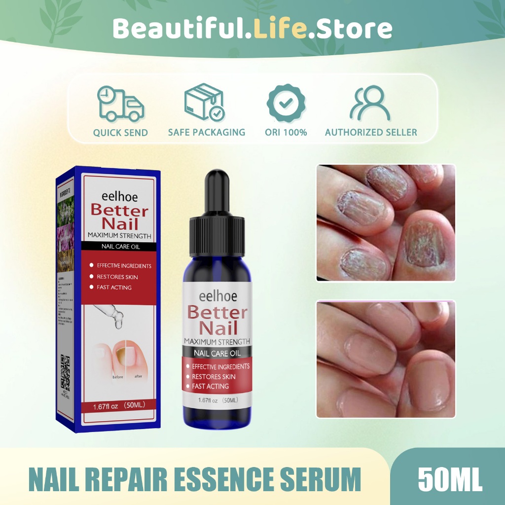 Jual EELHOE Nail Repair Essence Serum 50ml 100% Original Serum Kuku ...