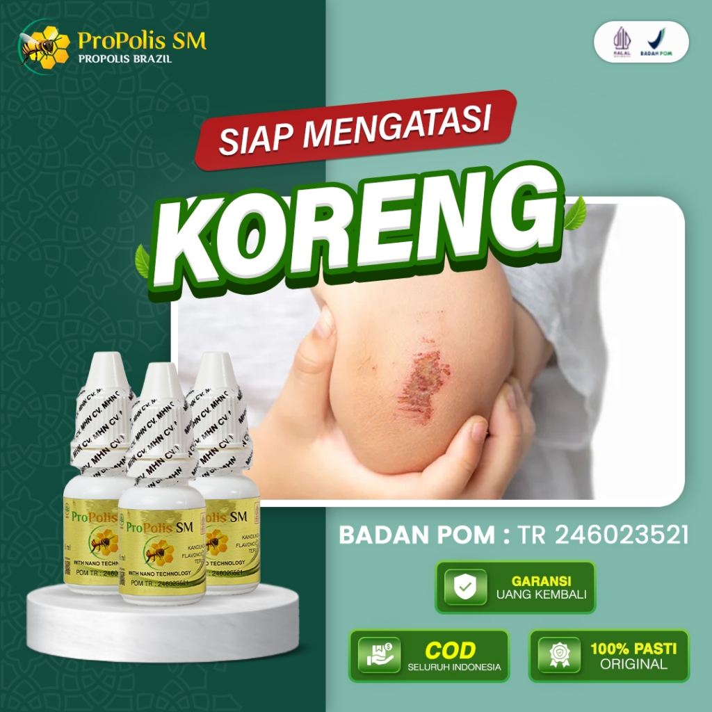 Jual Obat Koreng Budug Borok Kadas Kurap Eksim Herpes Gatal Di ...