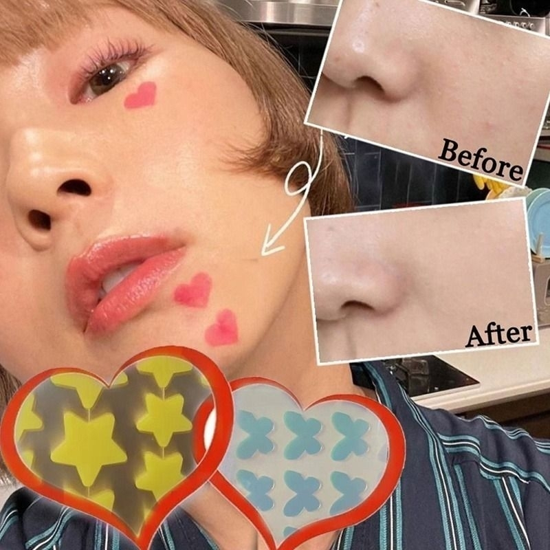 Jual Acne Patch Lucu Sticker Jerawat Hydrocolloids Pimple Patch Repair ...