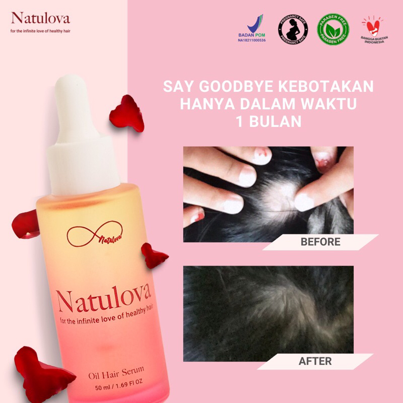 Jual Hair Oil Anti Botak - Hair Oil Serum Menumbuhkan Rambut | Shopee ...