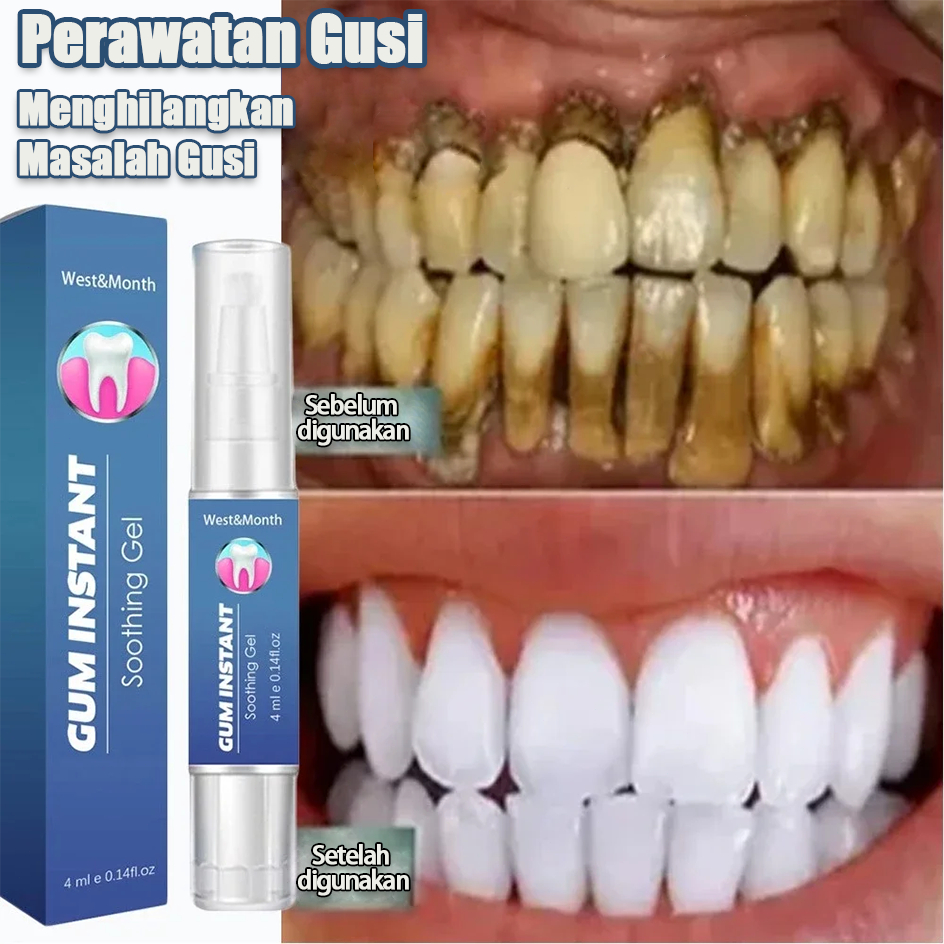 Jual gum instant untuk gigi Penghilang karang gigi membandel hkan plak ...