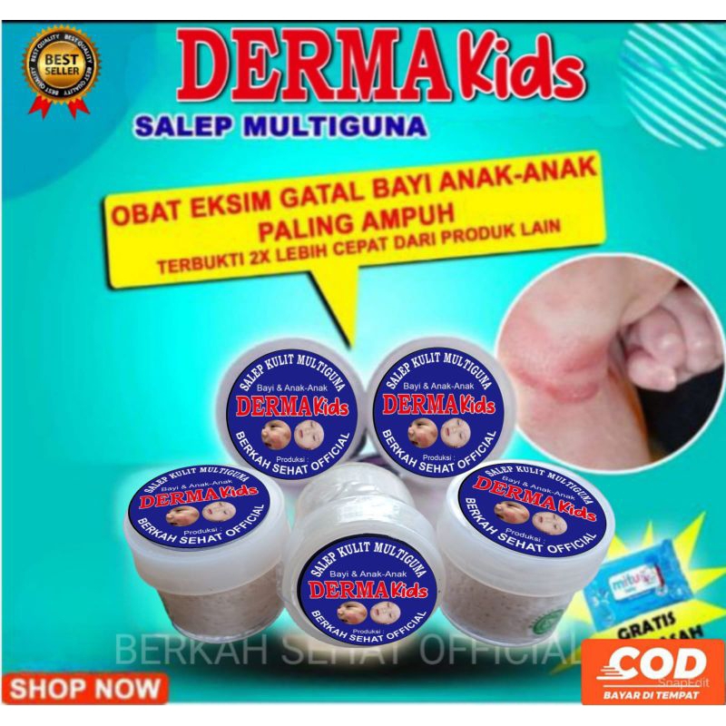 Jual Salep Gatel Selangkangan,Salep Multiguna DERMA Kids RACIKAN APOTIK ...