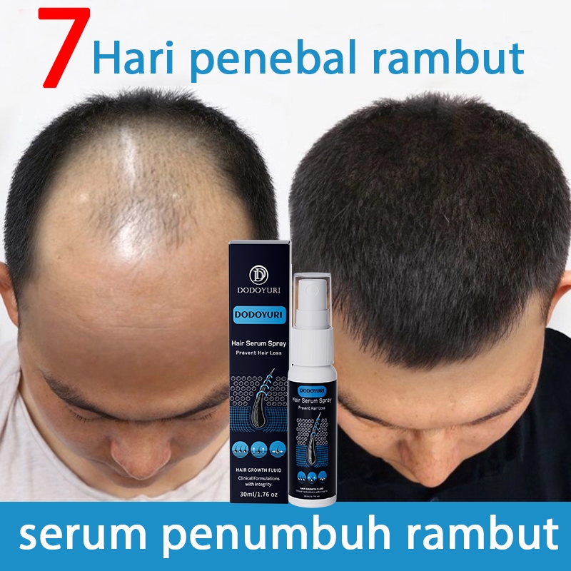 Jual 【BPOM】Serum penumbuh rambut penumbuh rambut botak penebal rambut ...