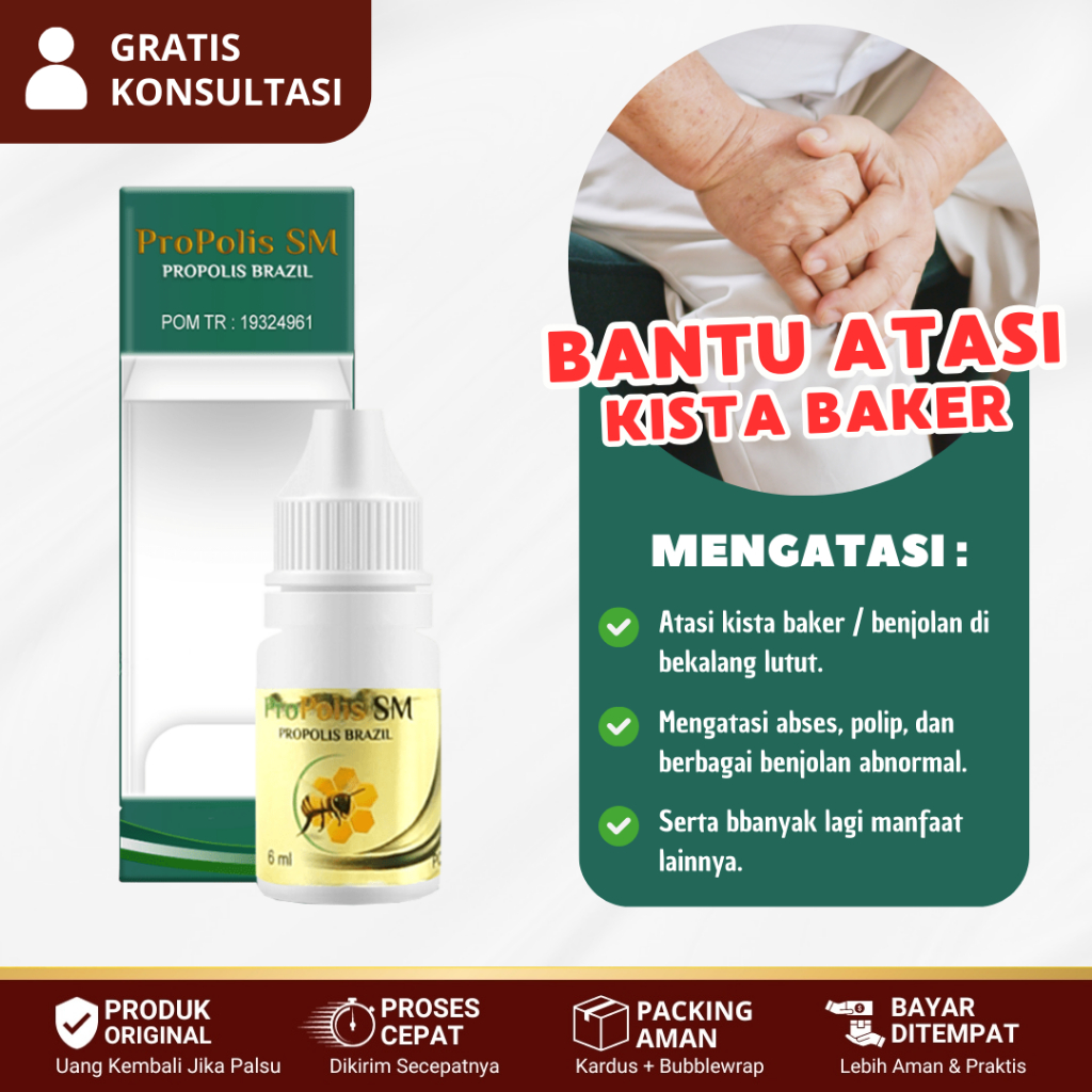 Jual Obat Kista Baker / Kista Poplitea, Benjolan Di Belakang Lutut ...