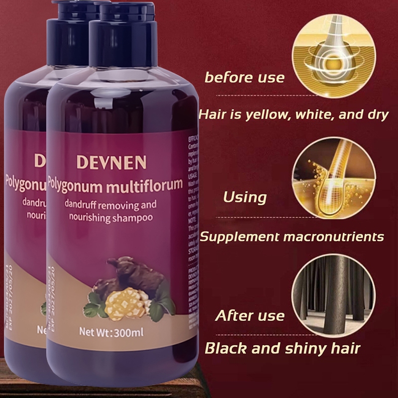 Jual 300ml Shampoo Uban Menjadi Hitam Permanen Penghitam Rambut Black ...