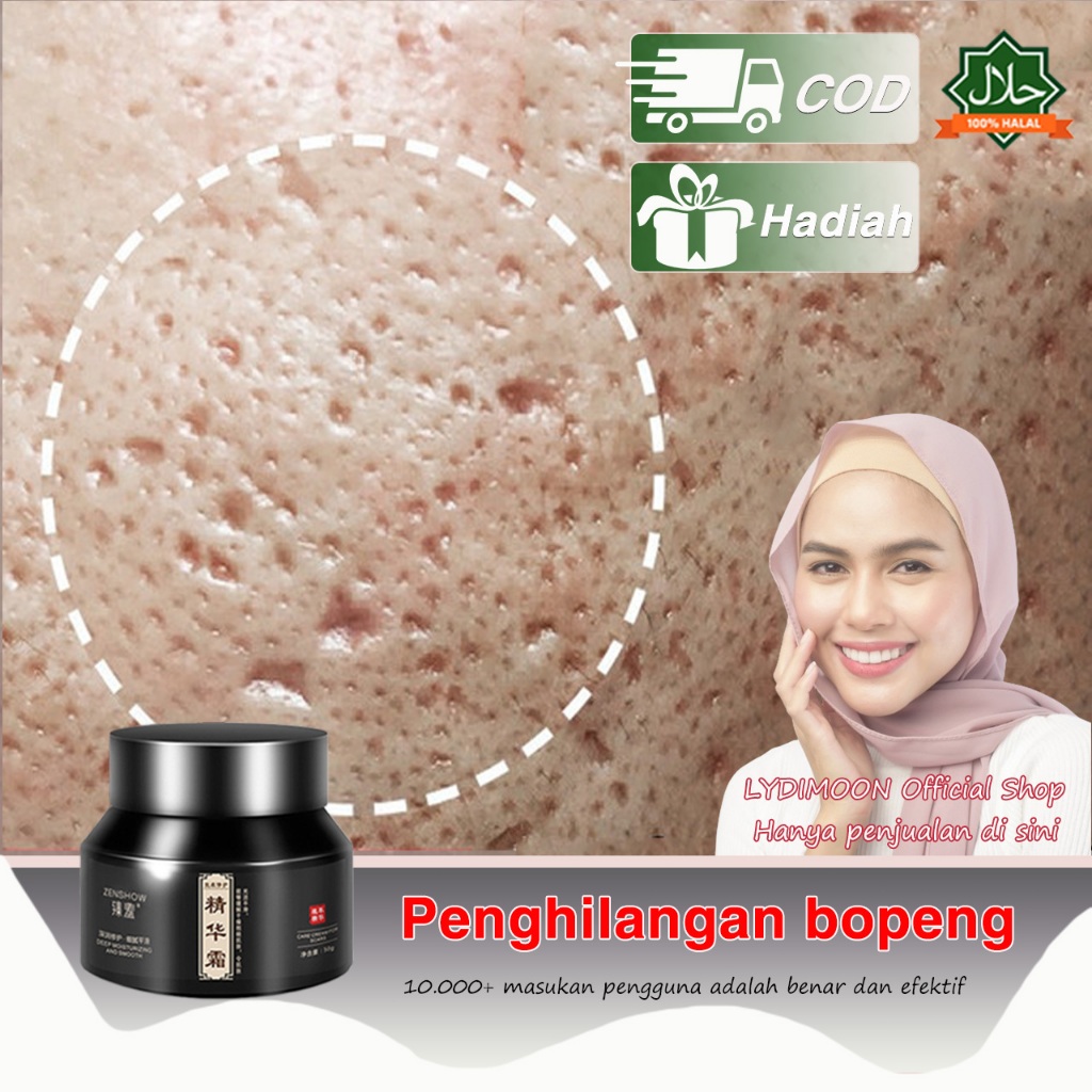 Jual Cream Penghilang Bekas Jerawat | Bopeng,dan Flek | penghilang ...