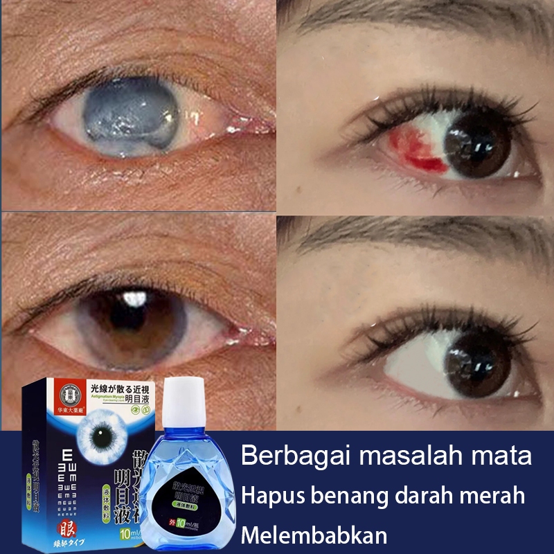 Jual obat mata10ml Obat Mata Katarak Mata Kering Sakit Mata kering ...
