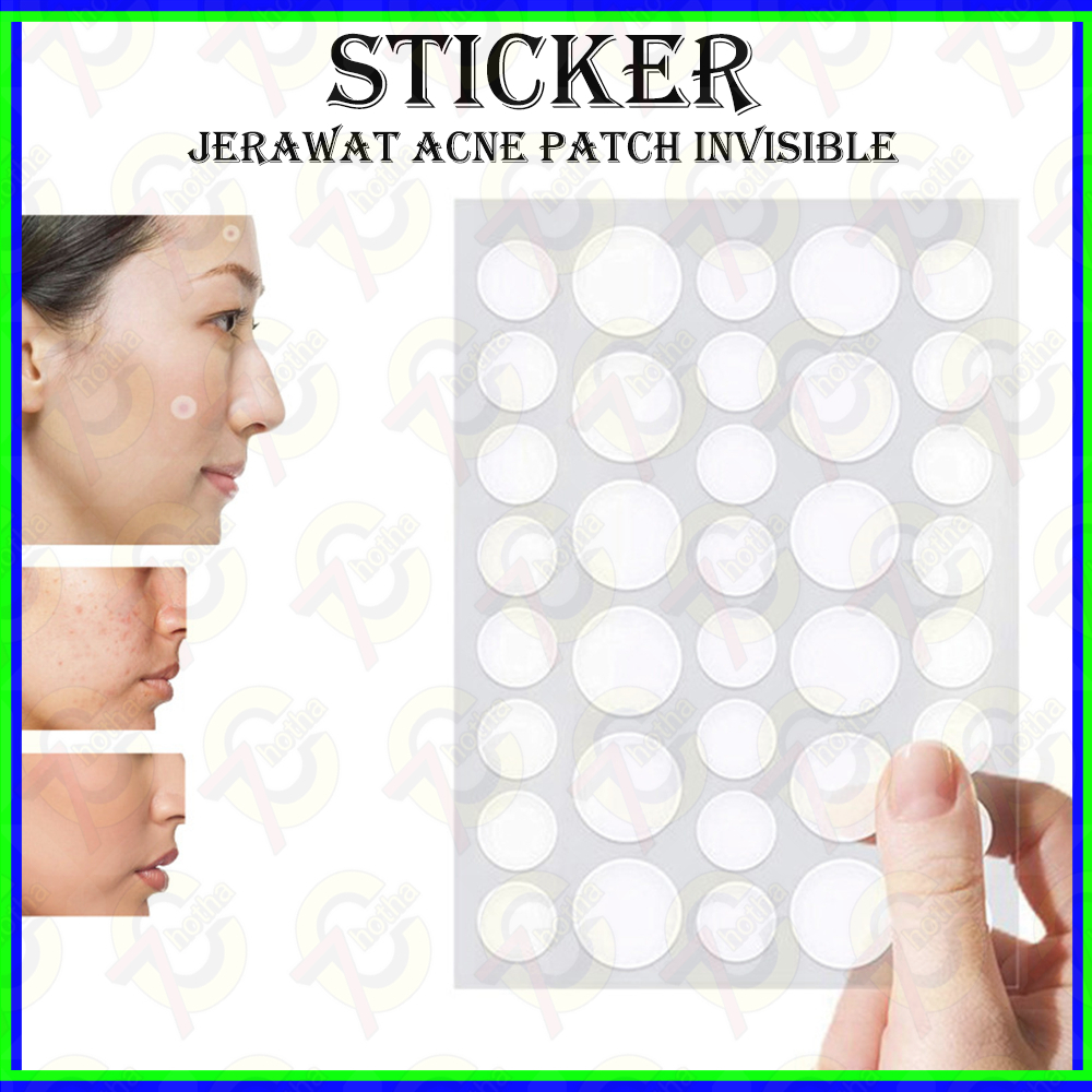 Jual Sticker Jerawat Acne Patch Invisible Penghilang Jerawat Kempes ...