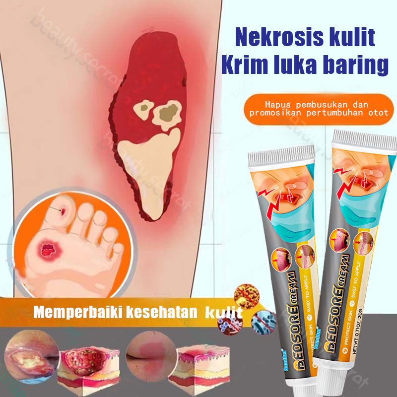 Jual Krim Luka Baring 20g Mempromosikan perbaikan daging dan bekas luka ...