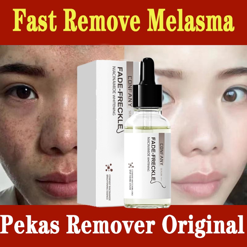 Jual Freckles Remove Dark Spots Serum Nicotinamide Whitening Serum 30ml Dark Spots Melasma ...