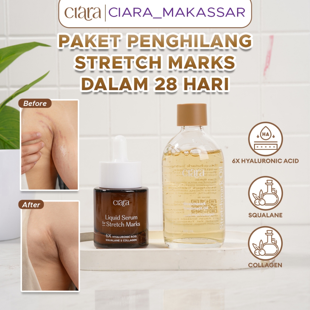 Jual Ciara Stretchmark Treatment Oil X Stretchmark Serum | Shopee Indonesia