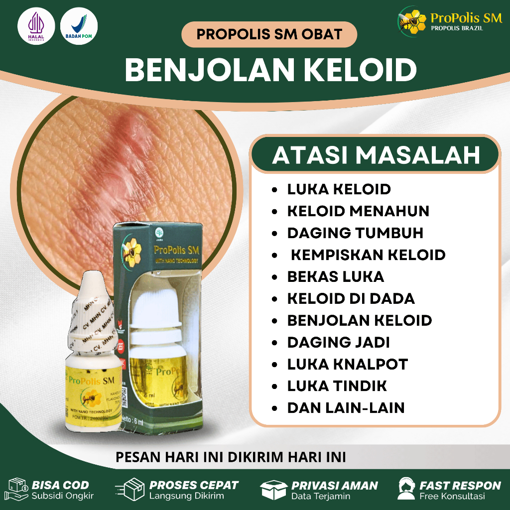 Jual Obat Keloid Penghilang Bekas Luka Daging Tumbuh Kutil Skin Tag ...