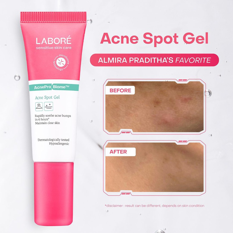 Jual DC LABORE Acne Spot Gel (15ml) | Shopee Indonesia